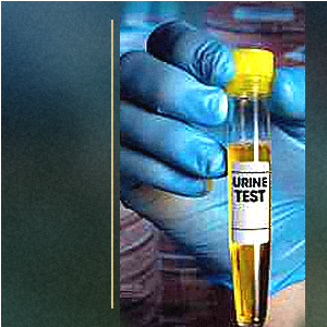 Drug Testing in the Army (Urinalysis)